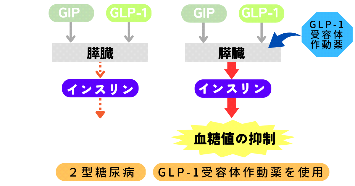 GLP-1受容体作動薬の効果と副作用 | 【公式】元住吉駅前こころみクリニック 【内科・小児科・耳鼻咽喉科・婦人科】